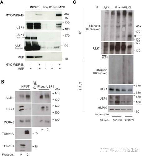 USP1靶向ULK1并调节其细胞区室化和自噬 - 知乎