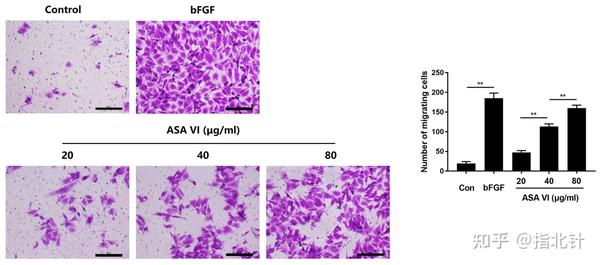 Transwell实验——原理、步骤、注意事项、示例图 - 知乎