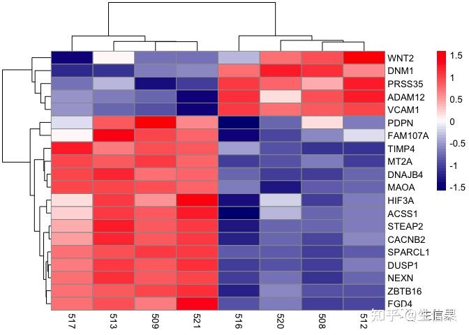 空间分辨率、基因表达和数据可视化的佼佼者 -- R语言包SaberR - 知乎