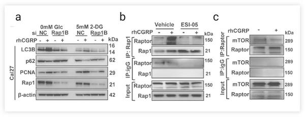 CGRP通过破坏mTOR-Raptor相互作用促进癌症进展 - MedChemExpress - 知乎