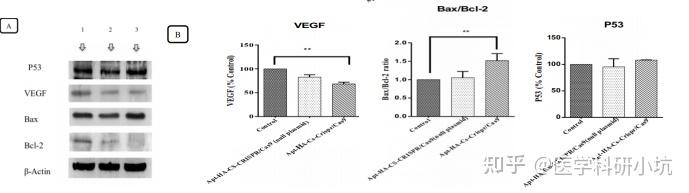 Western Blot在肿瘤治疗中的应用 - 知乎
