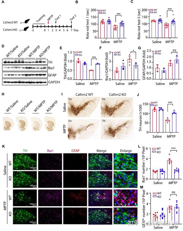 Sci Adv+Theranostics︱军事医学研究院袁增强/中央民族大学程金波团队揭示钙稳态调节蛋白Calhm2调控神经退行性疾病新机制 - 知乎