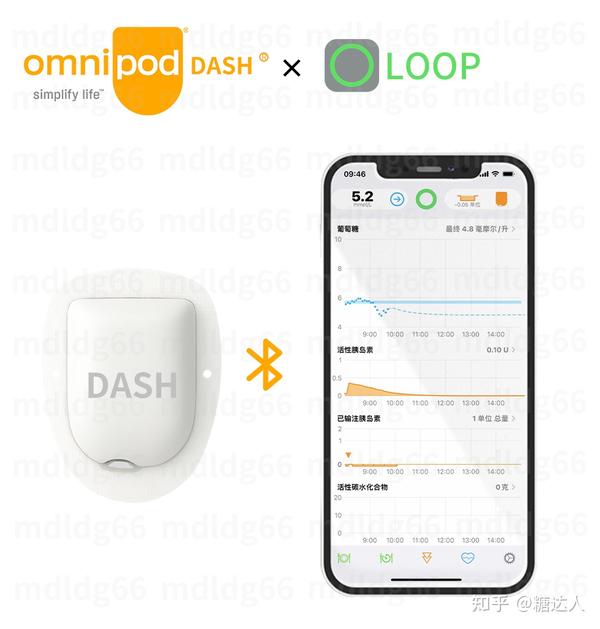胰岛素泵闭环之——Omnipod DASH（无管路胰岛素泵） - 知乎