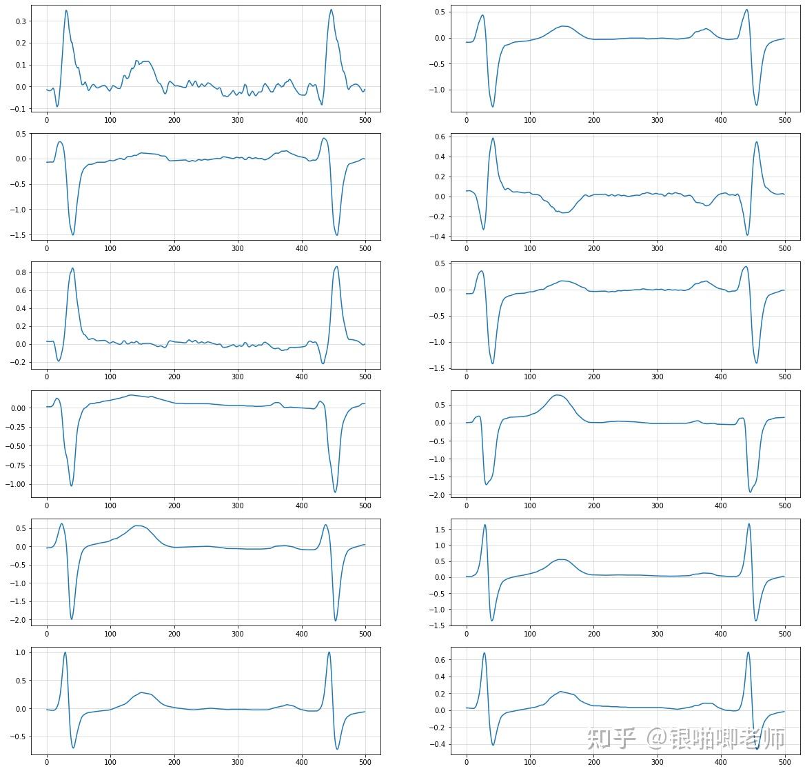 PTB-XL心电随机分类 - 知乎