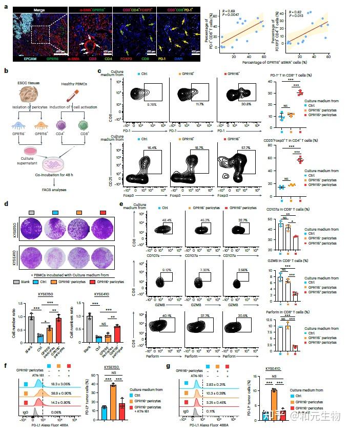 Nature genetics| ESCC GPR116+周细胞通过PRRX1-EGFL6-整合素β1-NF-kB轴调控肿瘤转移 - 知乎