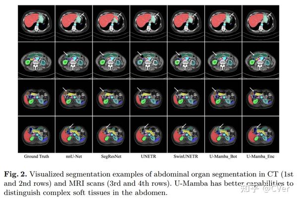 革新医学图像分割！刷新多个SOTA！U-Mamba：生物医学图像分割新网络 - 知乎