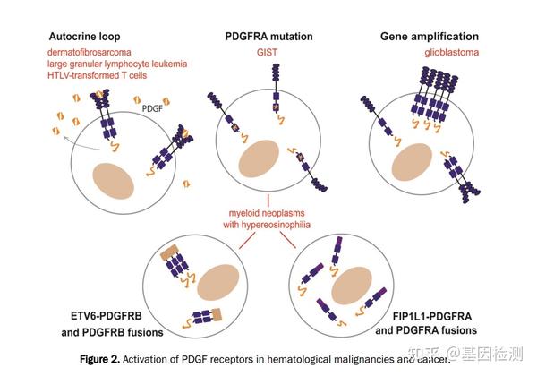PDGFRA基因与癌症 - 知乎