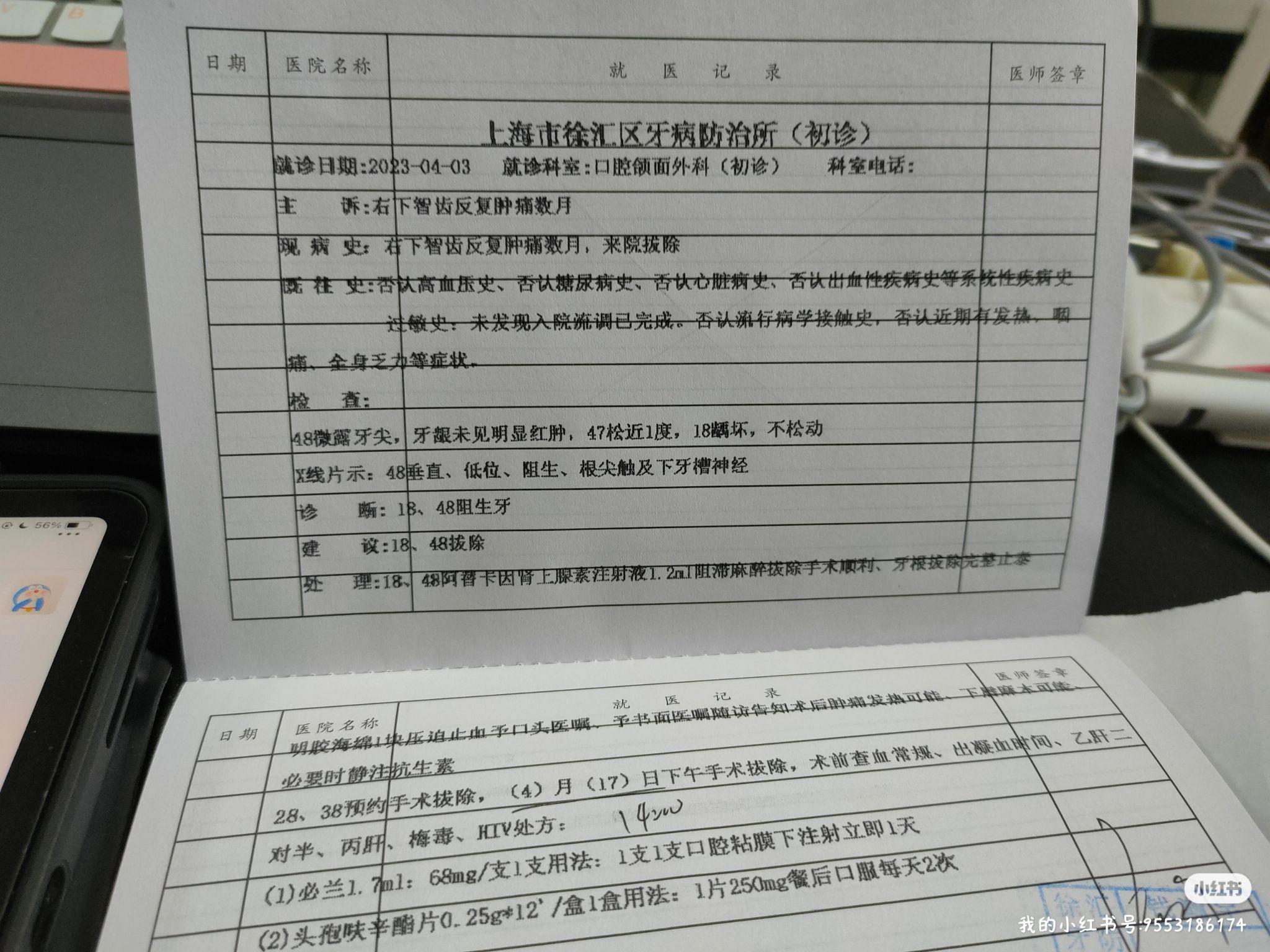 上海徐汇牙防所拔智齿分享 - 知乎