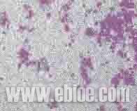 Transwell实验方法 - 知乎