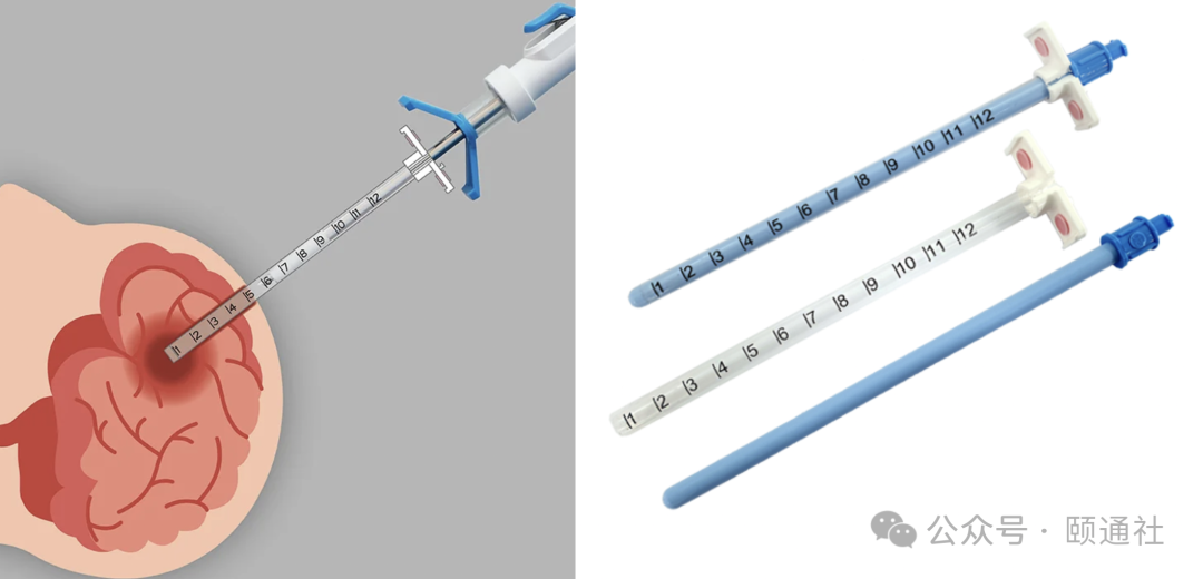 美国首款！新型一次性神经内镜获批FDA - 知乎