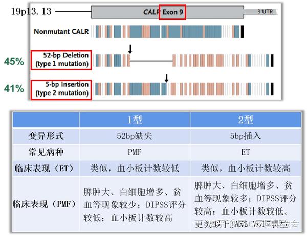 经典型MPN：PV/ET/PMF （1） - 知乎
