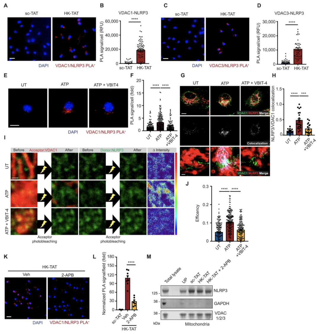 Science Immunology丨己糖激酶从线粒体解离促进 VDAC 寡聚化，从而促进 NLRP3 炎性体组装和激活 - 知乎