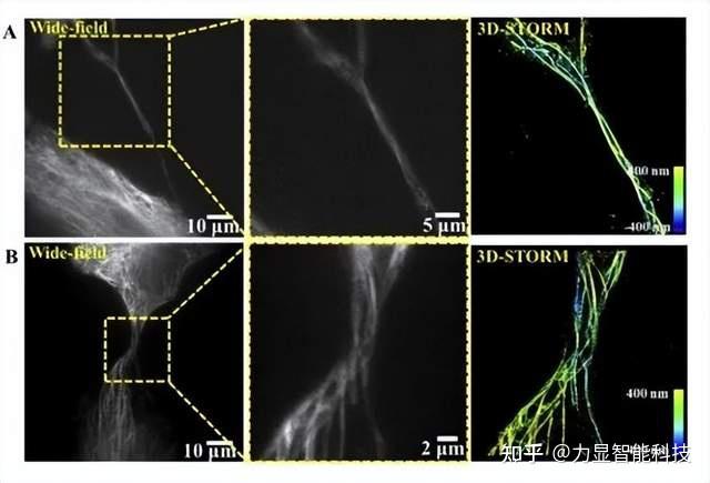 用STORM成像揭示细胞间隧道纳米管（TNTs）的结构和组织 - 知乎