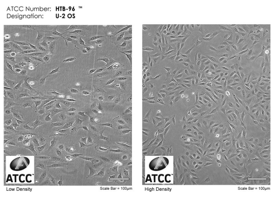 U-2OS细胞培养，人骨肉瘤细胞培养攻略 - 知乎