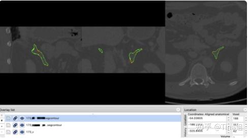 fsleyes -- 一款多功能影像数据查看器 - 知乎