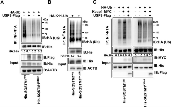 泛素特异性蛋白酶USP8直接对SQSTM1/p62进行去泛素化，以抑制其自噬活性 - 知乎