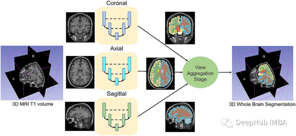 实践教程｜使用Pytorch对MRI脑扫描的图像进行分割 - 知乎