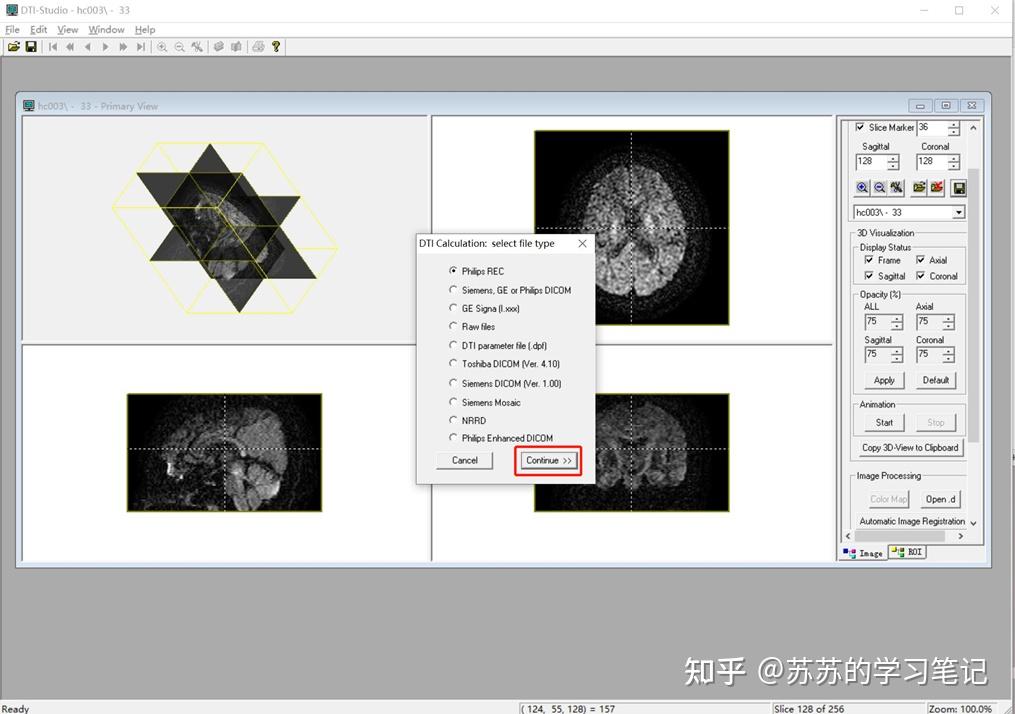 DTI Studio操作教程 - 知乎