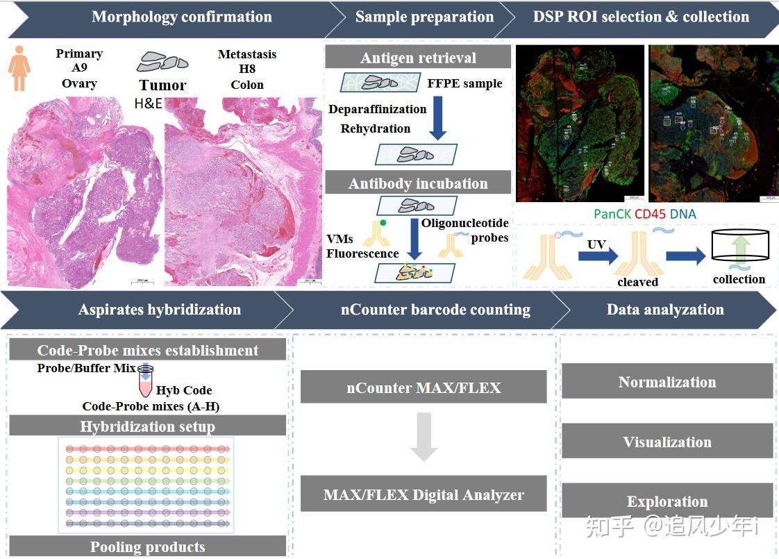 DSP(Digital Spatial Profiler)技术在神经内分泌肿瘤方面的运用 - 知乎