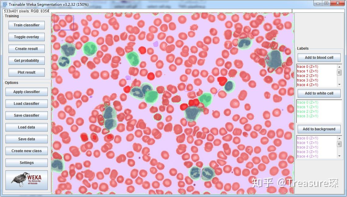 ImageJ实用技巧——基于机器学习的自动细胞分割(插件篇) - 知乎