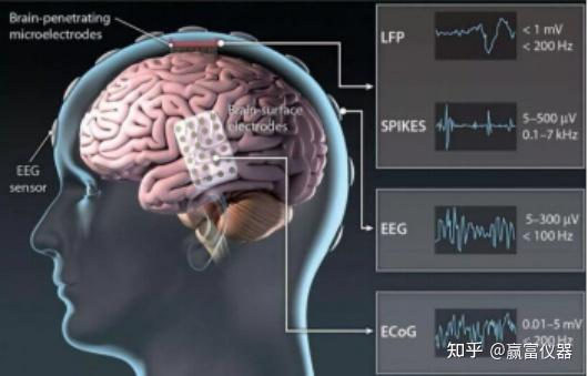 一文详解脑电图（EEG）的原理与应用 - 知乎
