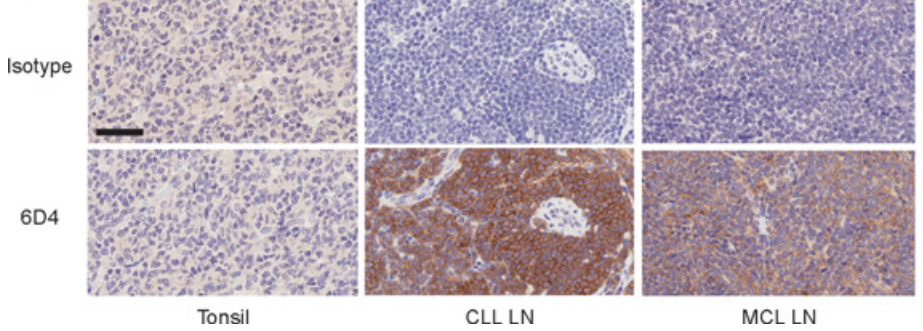 杰论系列 | 肿瘤免疫治疗新兴靶点ROR1 - 知乎