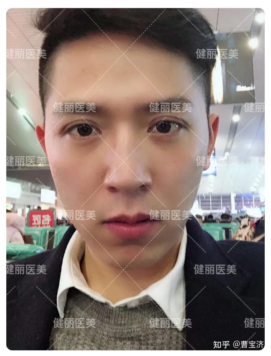 长期熬夜形成的眼袋如何去除?这些小妙招你真的要知道! 知乎