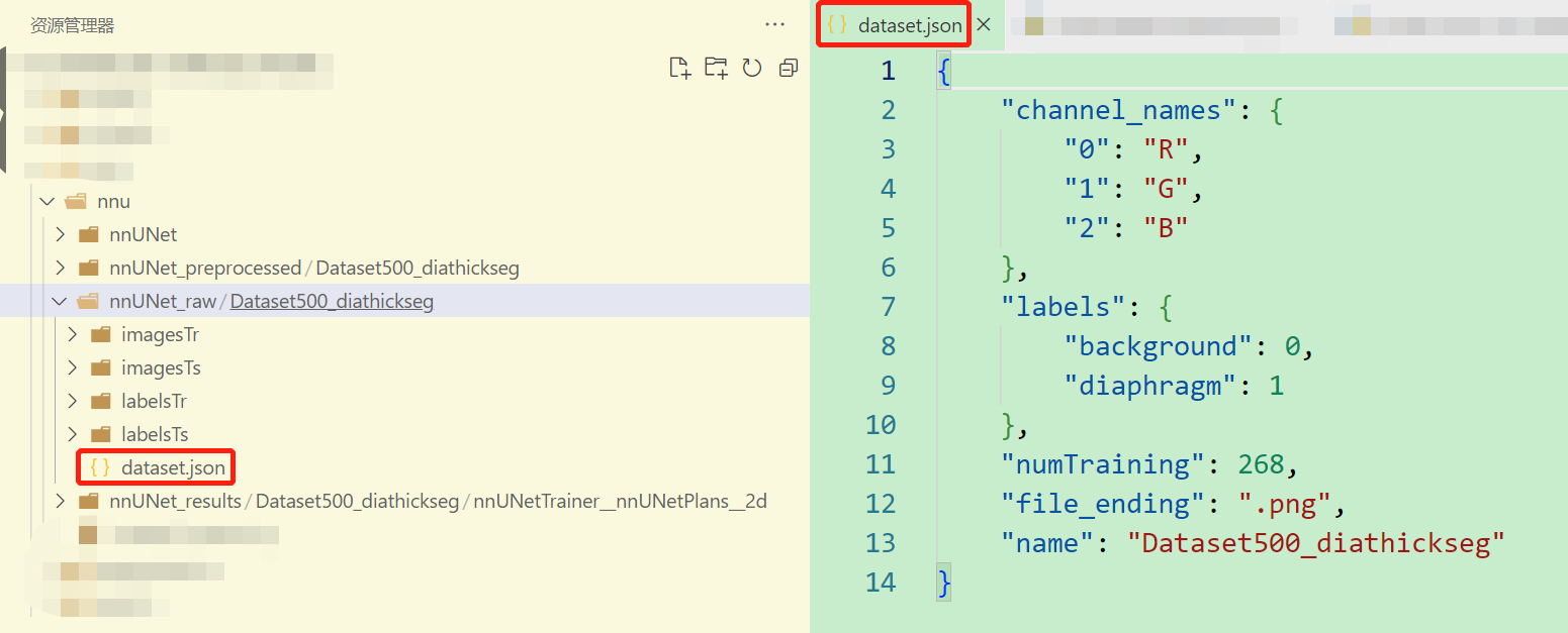 nnUnet v2项目学习记录，训练自定义模型（不是Unet） - 知乎