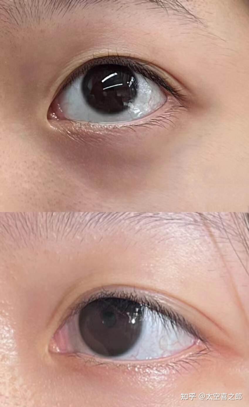 【中科院博士＋央视网】受我一拜！咖啡因眼霜去黑眼圈、消肿淡纹巨厉害！ - 知乎