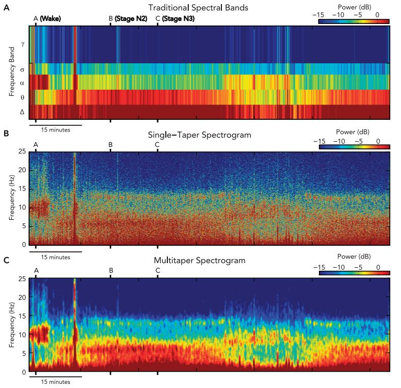 【Lunion Stage】如何使用频谱图提高睡眠分析效率 - 知乎