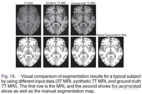 不同模态MRI医学图像合成 - 知乎
