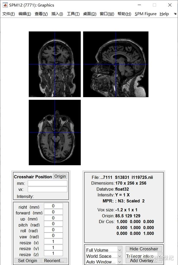 基于SPM的磁共振图像(MRI)手动ACPC矫正 - 知乎