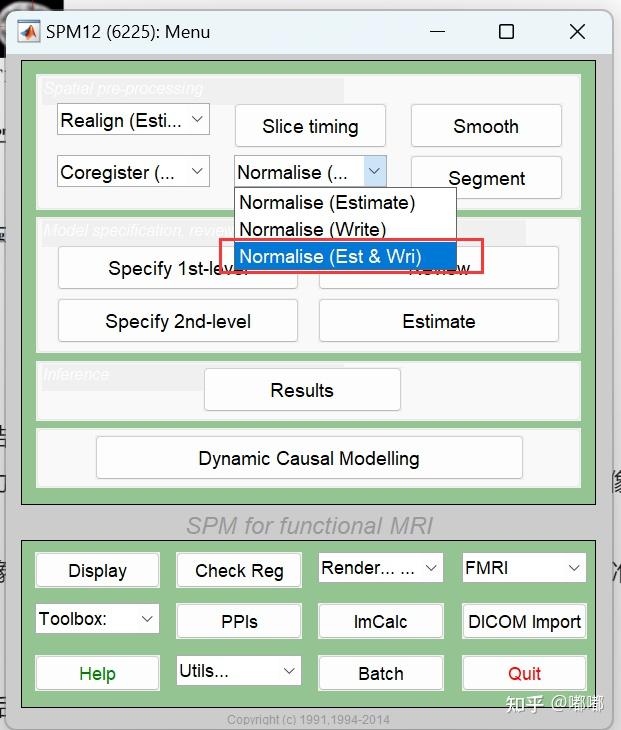 3-spm-fMRI任务态数据分析——预处理（下） - 知乎
