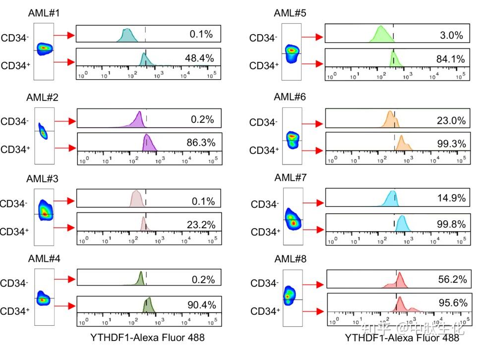 Cancer Res: 急性髓系白血病进展需要RNA m6A阅读器YTHDF1 - 知乎
