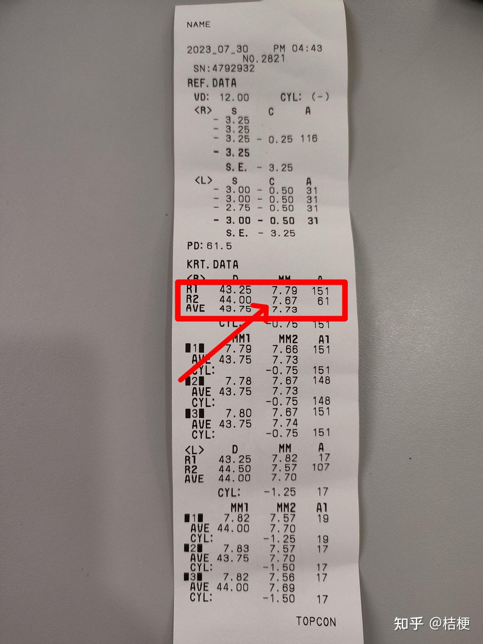 隐形眼镜基弧到底怎么选 知乎