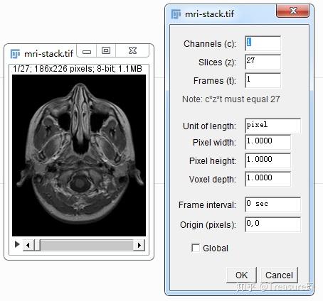 ImageJ实用技巧——重新认识你的图像(基本功能篇) - 知乎