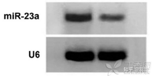 miRNA Northern Blot实验技术应用 - 知乎