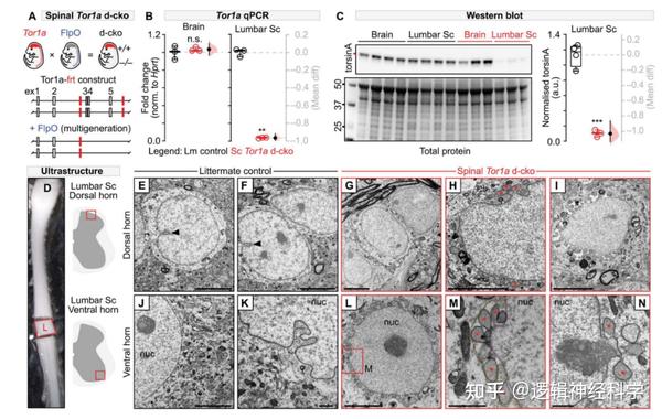 STM︱伦敦大学学院团队发现脊髓神经回路功能障碍介导的Dyt1-Tor1a肌张力障碍小鼠的病理发生机制 - 知乎