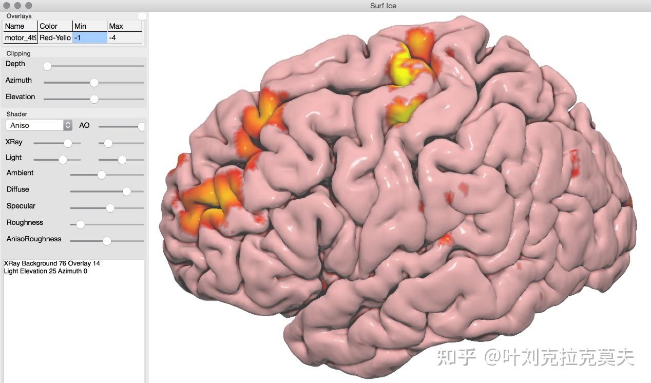 科学可视化软件介绍 – 人类大脑解剖图可视化软件Surf Ice - 知乎