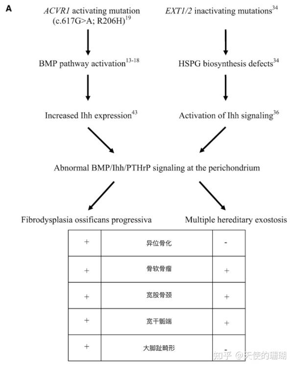 FOP患者的胫骨近端骨软骨瘤 - 知乎