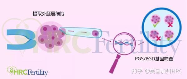 HRC课堂 | 胚胎等级 vs PGS/PGD，哪个才是衡量胚胎移植的最佳标准？ - 知乎