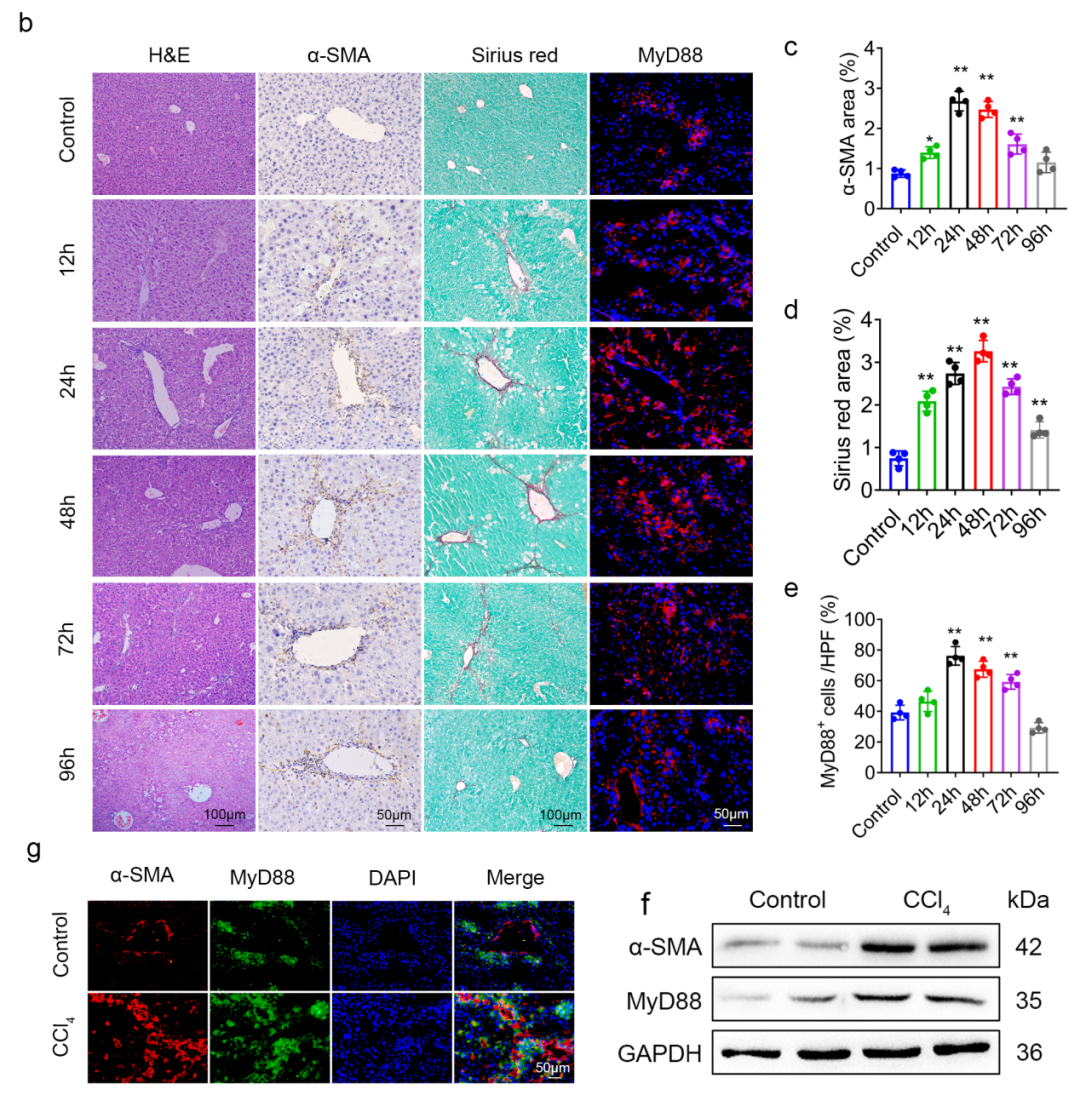 Cell Death Dis︱ 张金华课题组揭示肝纤维化新机制：肝星形细胞中MyD88通过促进巨噬细胞M1极化增强肝纤维化 - 知乎