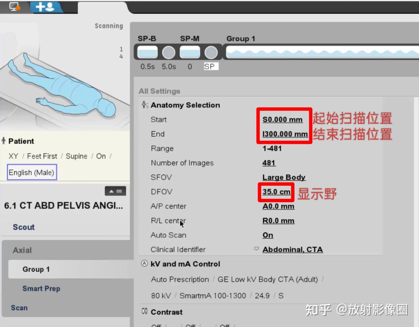 GE Revolution CT操作指南及问题汇总(一) - 知乎