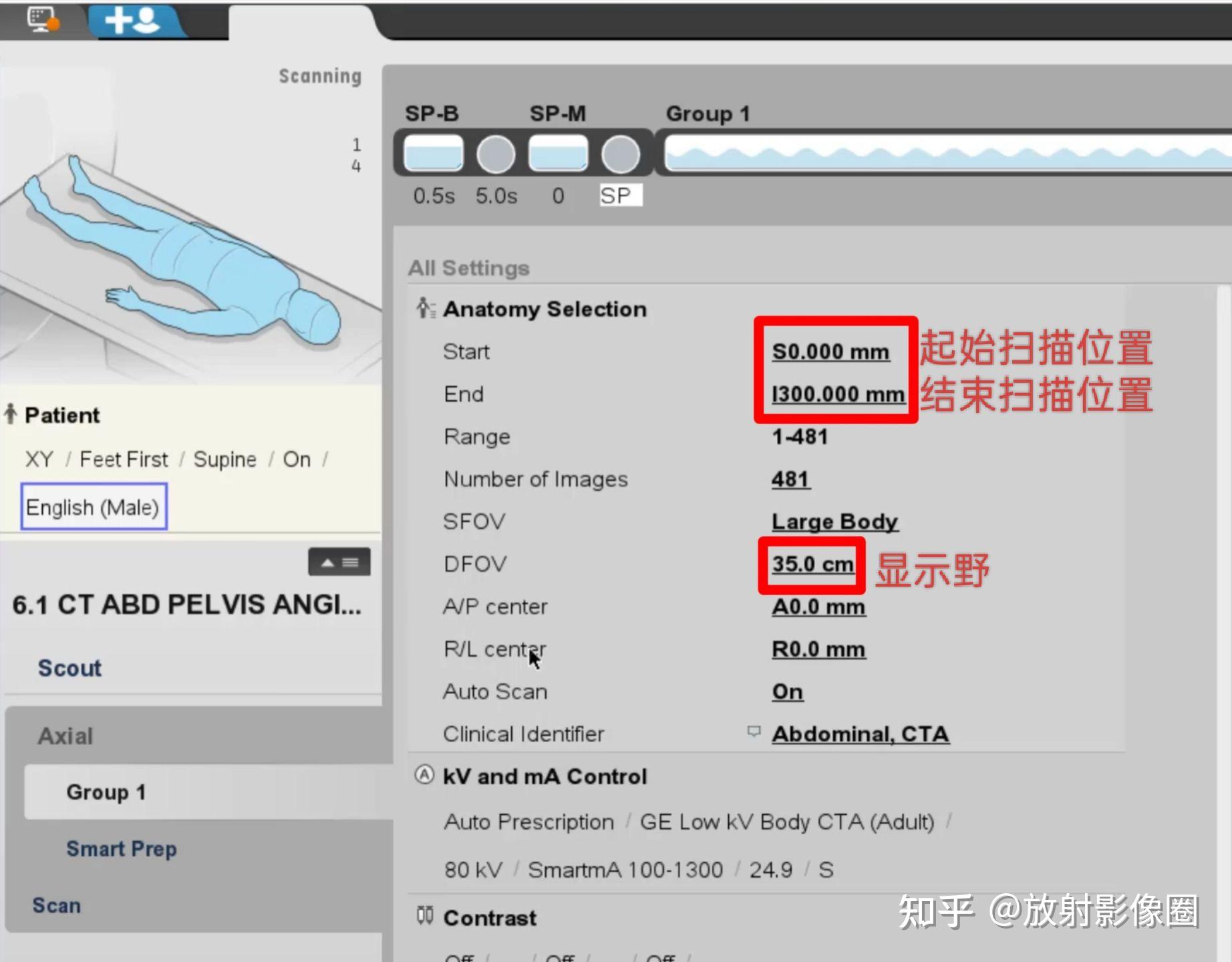 GE Revolution CT操作指南及问题汇总(一) - 知乎