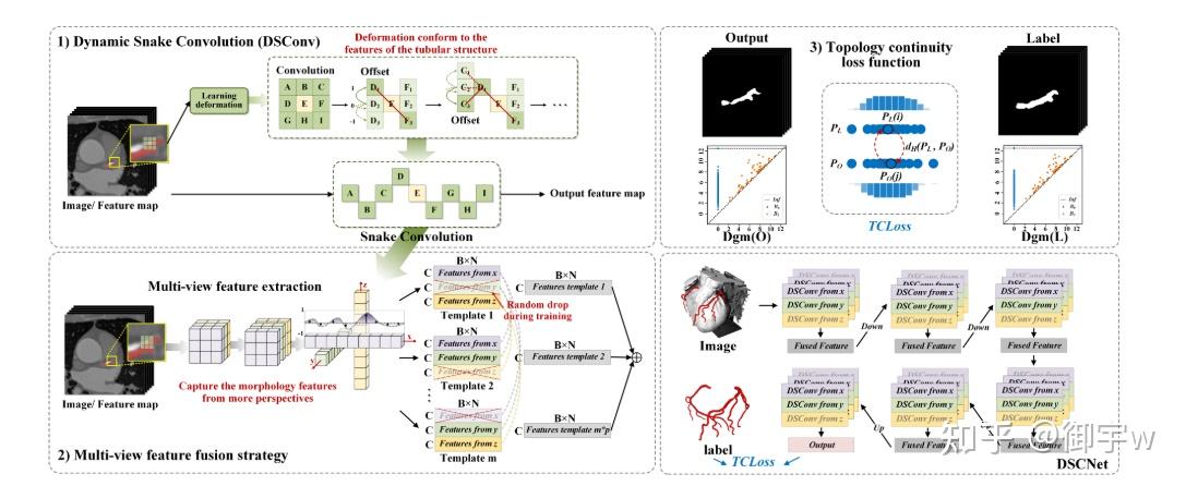 (即插即用模块-Convolution部分) 三、(ICCV 2023) DSConv 动态蛇形卷积 - 知乎