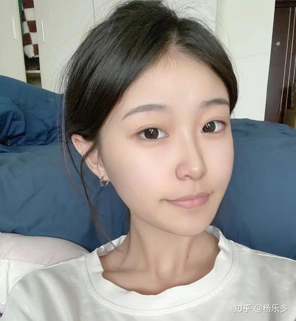 鼻子上的黑头能去掉吗?有什么好的解决办法? 知乎