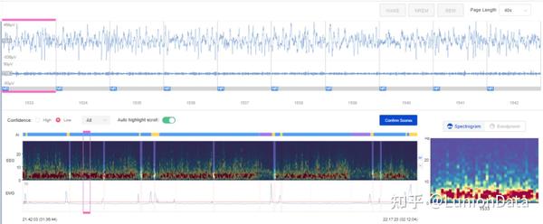 【脑科学】基于EEG的小动物睡眠研究 - 知乎