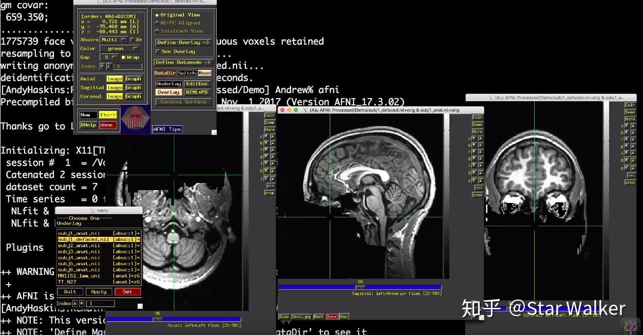 介绍几款DICOM匿名化工具 - 知乎