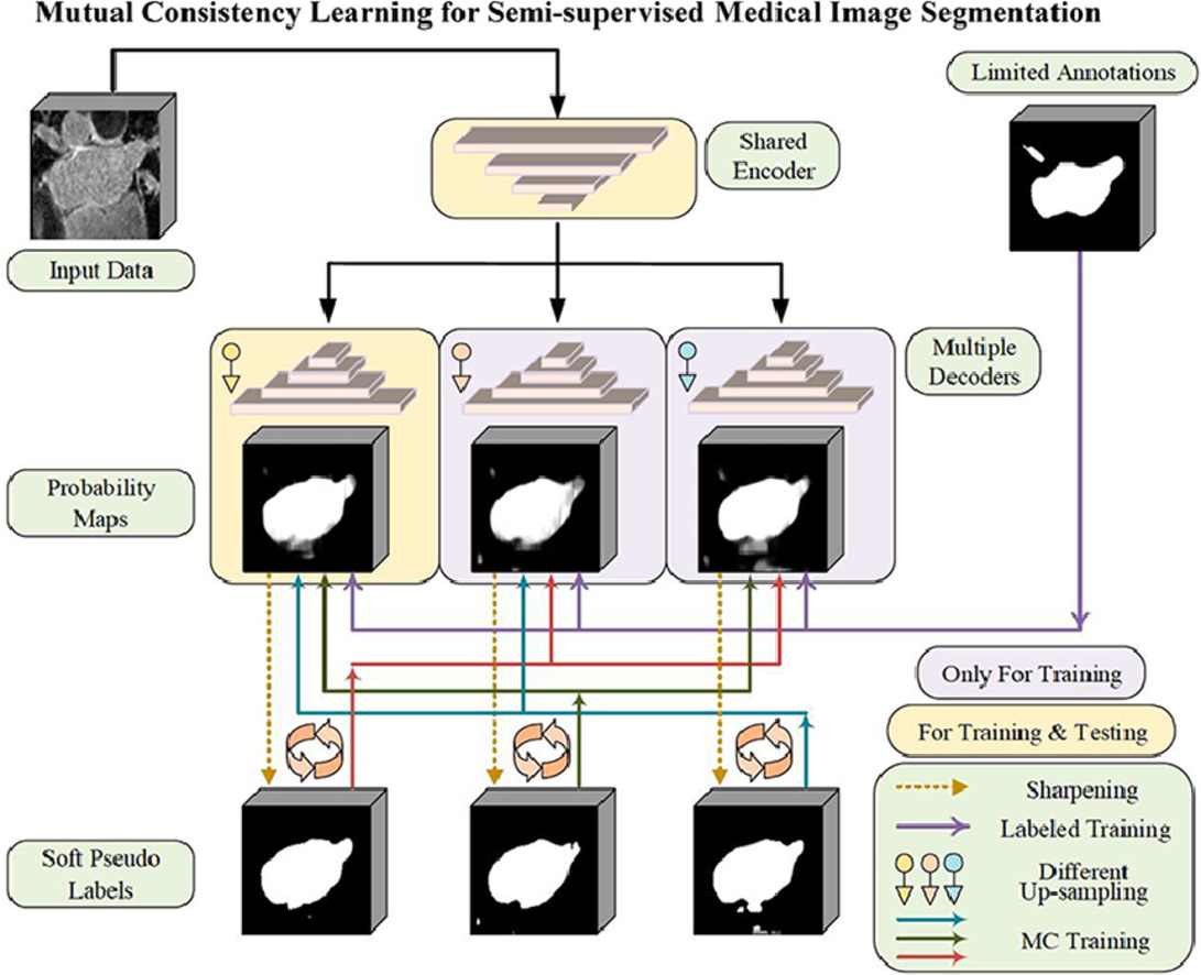 MC_Net：基于互一致性的半监督医学影像分割 - 知乎