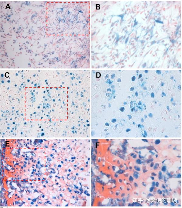 鉴定祖细胞对异位骨发生的贡献 - 知乎